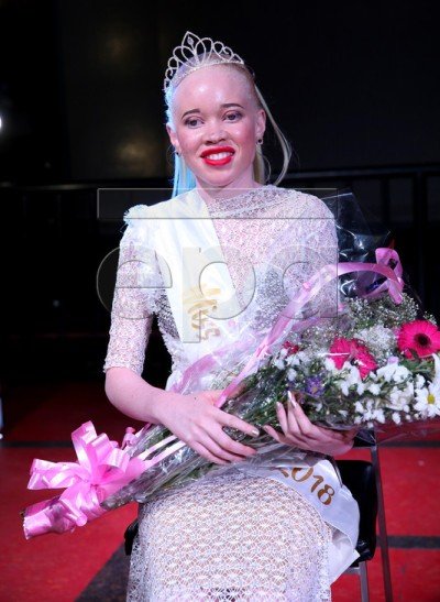 Zimbabwe crowns first ‘Miss Albino’ – P.M. News