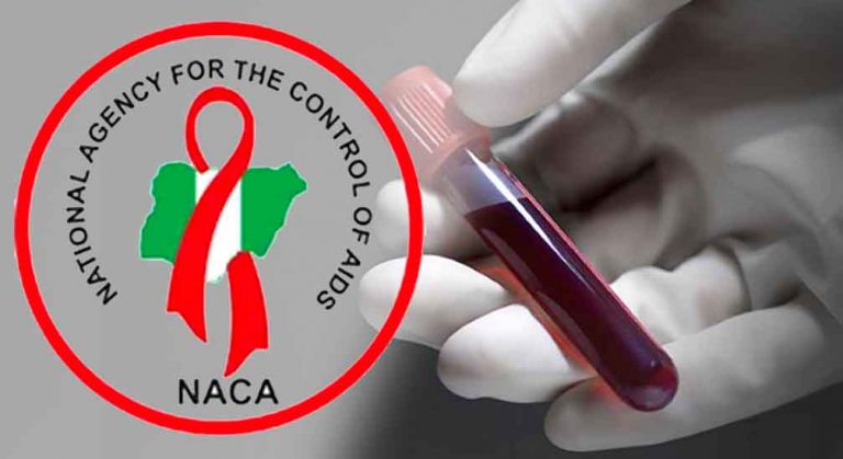 Nigeria to begin production of HIV/AIDS test kits, anti-retroviral ...