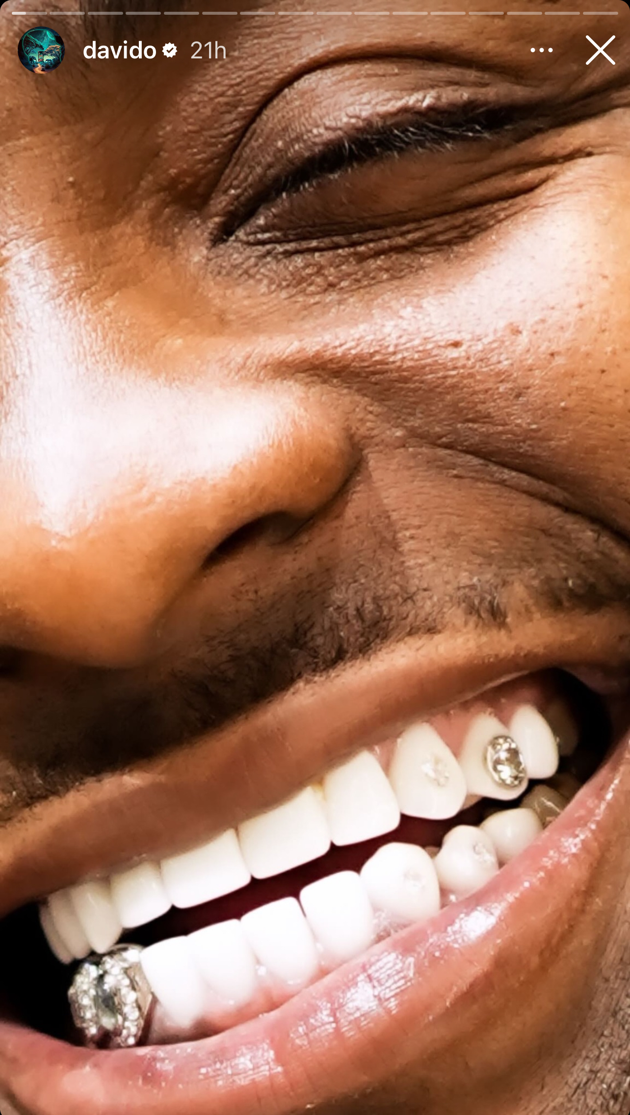 Davido shows off new gold necklace, diamond teeth (Photos) - P.M. News