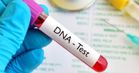 25 per cent paternity tests negative - DNA Centre - P.M. News